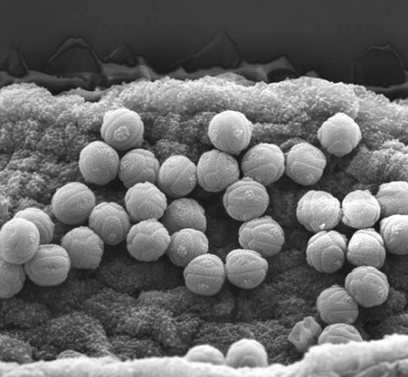 Fascinating forget-me-not pollen | Te Papa’s Blog